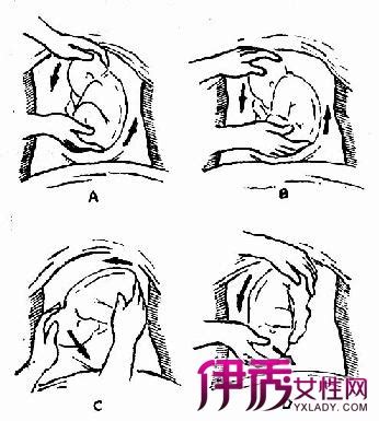 胎儿臀位图片图胎儿臀位图片集 臀位是常见的异常胎位 伊秀亲子 yxlady
