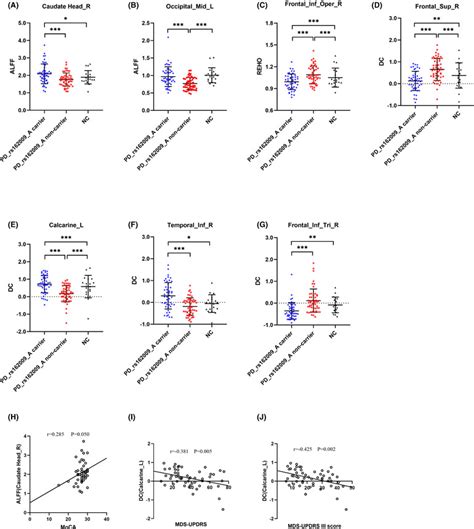 The Effects Of Aqp4 Rs162009 On Resting‐state Brain Activity In