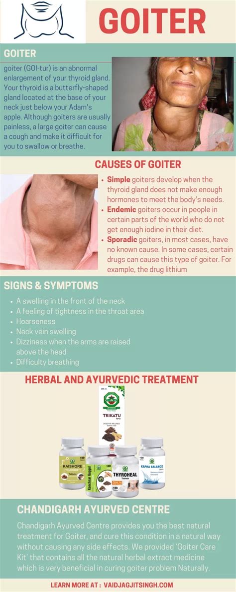 PPT Goiter Causes Symptoms Herbal Treatment PowerPoint Presentation ID