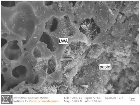 Occlusion Transition Zone At Arthur Walker Blog