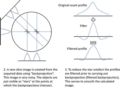 Spect Scanner Diagram