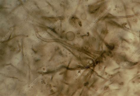 Lm Of Fossilised Algae Stock Image E440 0129 Science Photo Library