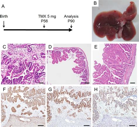 Icc Induction By Cholangiocyte Specific Kras Activation And Pten