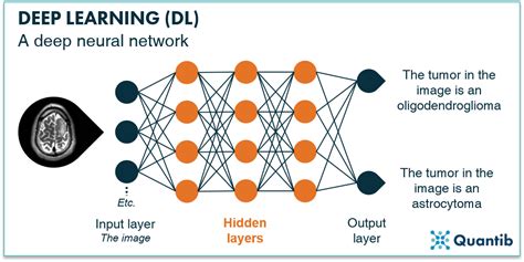 how does deep learning in radiology work