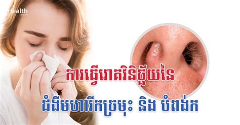 ការធ្វើ រោគវិនិច្ឆ័យ នៃ ជំងឺមហារីក ច្រមុះ និង បំពង់ក