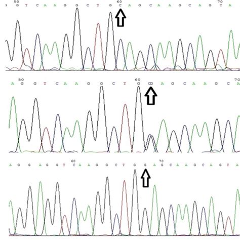 The Sequence Of Cc Cg And Gg Genotype The Arrow Showed The Mutation