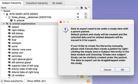 How To Export Totalsegmentator Results As Dicom Seg Support 3d Slicer Community