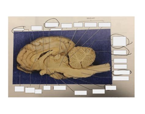 Sheep Brain Disection Quiz