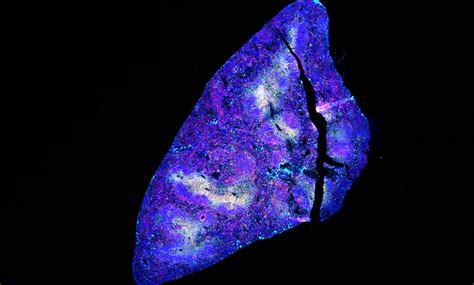 6 Plex Immunofluorescence Staining Dapi Six Marker Detection Ihisto