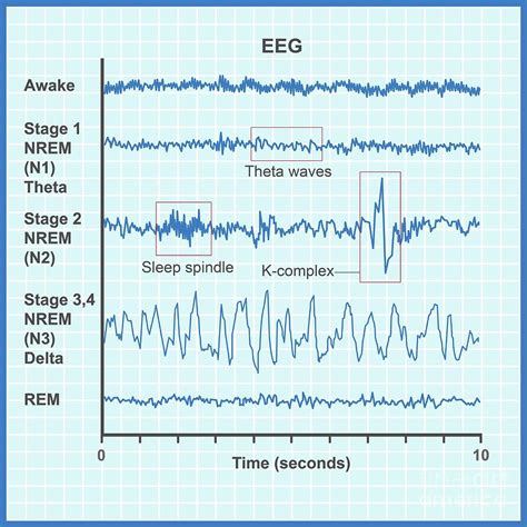 Eeg Sleep Stages 3 Photograph By Science Photo Library Pixels