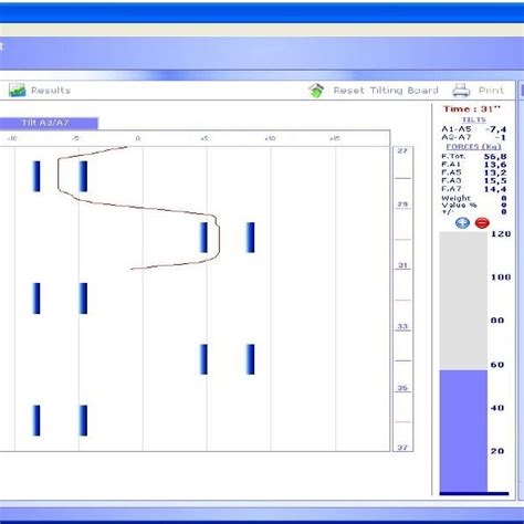 Dynamic Balance Test Equilibrium Disequilibrium Test Download Scientific Diagram