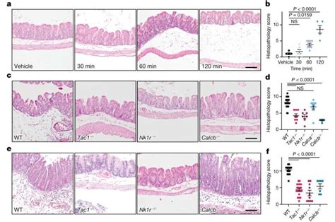 New Study In Mice Suggests Curbing Intestinal Inflammation Can Combat C