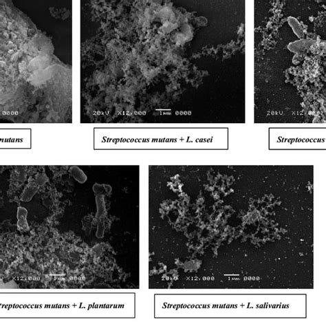 Scanning Electron Microscopy Sem Of The Biofilms Streptococcus Download Scientific Diagram