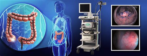 Colonoscopia O Manual Completo Que Você Precisa Antes De Fazer O Exame Dr Juliano Pimentel