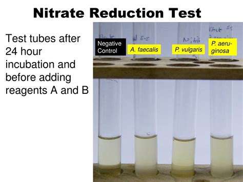 Ppt Ex 17 Nitrate Respiration Nitrate Reduction Test Powerpoint Presentation Id 2426462