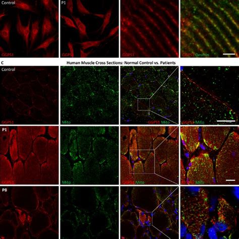 Geranylgeranyl Diphosphate Synthase Ggpps In Human Dermal Fibroblast Download Scientific