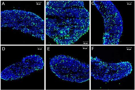Figure 3 From Rnai Mediated Gene Silencing In A Gonad Organ Culture To