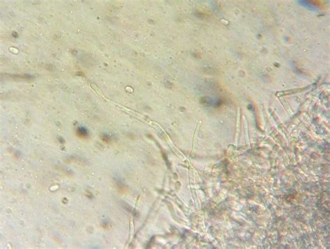 Weird And Wonderful Wild Mushrooms Choosing Between Sex And Celibacy Anamorphic Fungi I