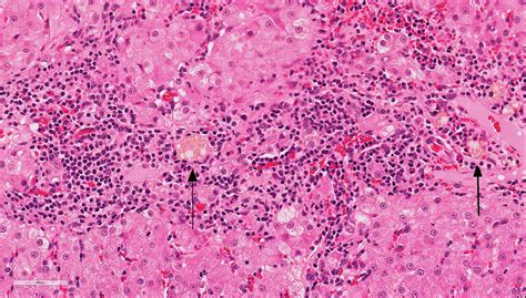 Conference 20 2018 Case 3 20180404