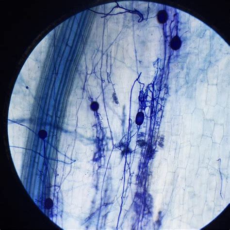 Mycorrhizae Microscope