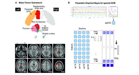 Procedures For Parametric Empirical Bays Peb Effective Connectivity Download Scientific