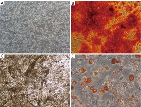 Andrographis Paniculata Ameliorates Estrogen Deficiency Related Osteoporosis By Directing Bone