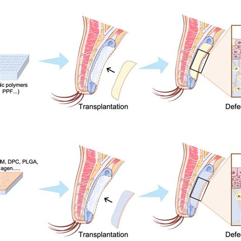 Schematic Diagram Of Acellular And Cellular Approaches For Posterior
