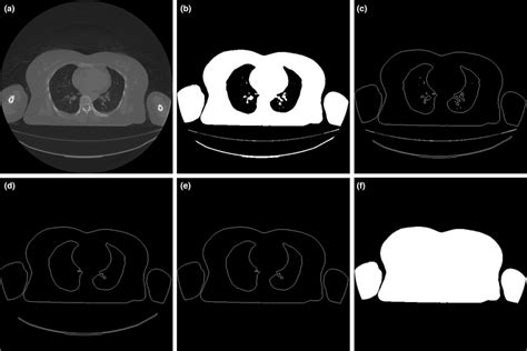 Proposed Automated Contouring Stages A Initial Image After Download Scientific Diagram