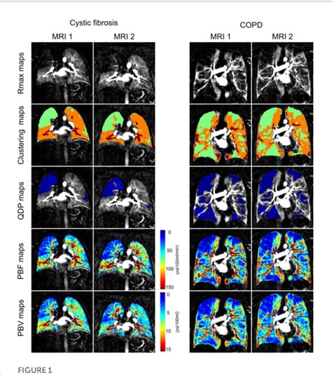 Figure 1 From Unsupervised Clustering Algorithms Improve The