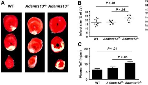 Figure 1 From Adamts13 Deficiency Exacerbates Vwf Dependent Acute