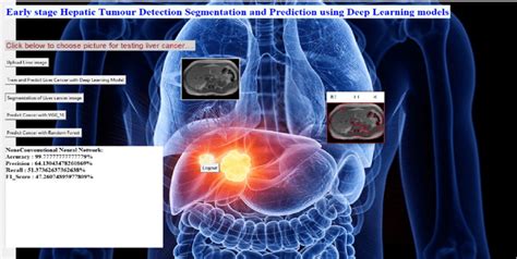 Segmentation Of The Liver And Cnn Results Download Scientific Diagram