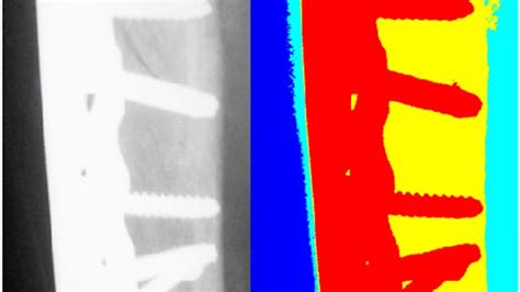 Introduction To Computer Vision Coursera