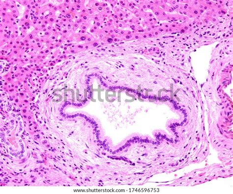Bile Duct Histology
