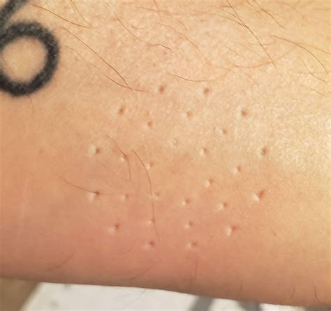 DIY Bondage Spikes Pain Play Kink Spikes Sexual Torture Etsy UK