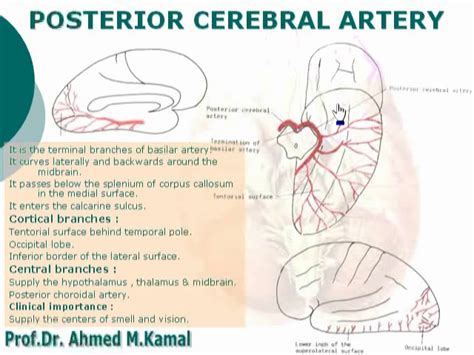 Posterior Cerebral Artery Segments