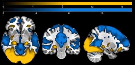 Spida Mri Behavioral And Fmri Data Of Adults With Fear Of Spiders