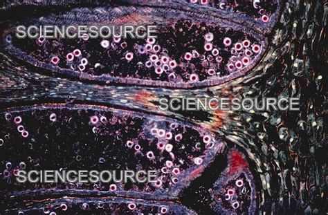 Equisetum Microscope