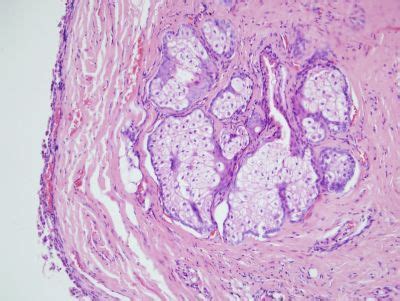 Eye Histology Tarsal Plate Histology Slide