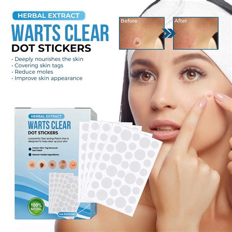 Parity Acne Pimple Patch 144 Counts Hydrocolloid Acne Patch With