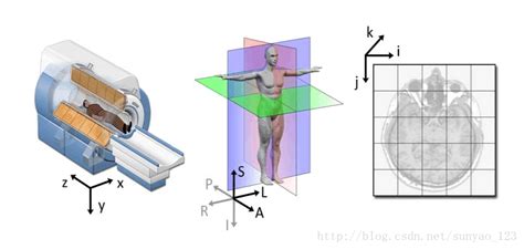Dicom医学图像读取涉及到的医学坐标体系dicom 坐标系 Csdn博客