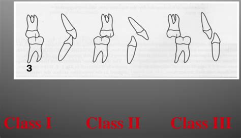 Occlusion Flashcards Quizlet