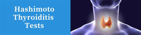 Hashimoto Thyroiditis Ulta Lab Tests