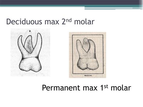 Ppt Primary Maxillary 2 Nd Molar Powerpoint Presentation Free