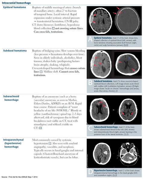 Intraparenchymal Hemorrhage Vs Subarachnoid Hemorrhage