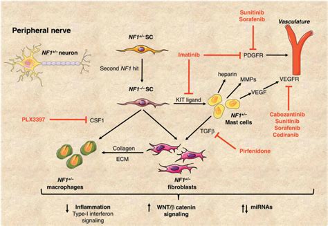 Plexiform Neurofibromas In Nf1 Plexiform Neurofibromas Pnfs Develop Download Scientific