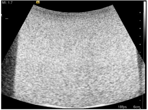 The B Mode Image Shows The Homogeneous Echogenicity That Was Common Download Scientific Diagram