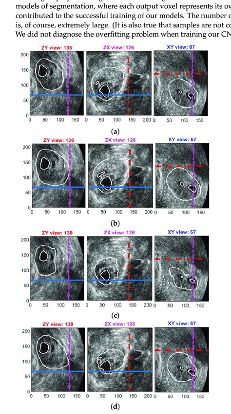Qualitative Results For The Better Compared Methods Detected Follicles