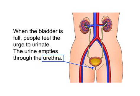 Foley Catheter Female