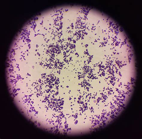 Staphylococcus Aureus Gram Positive Spherical Bacteria