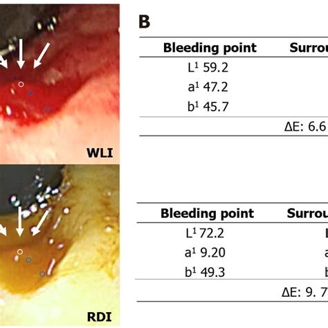 Color Values And Color Differences Between Bleeding Point And